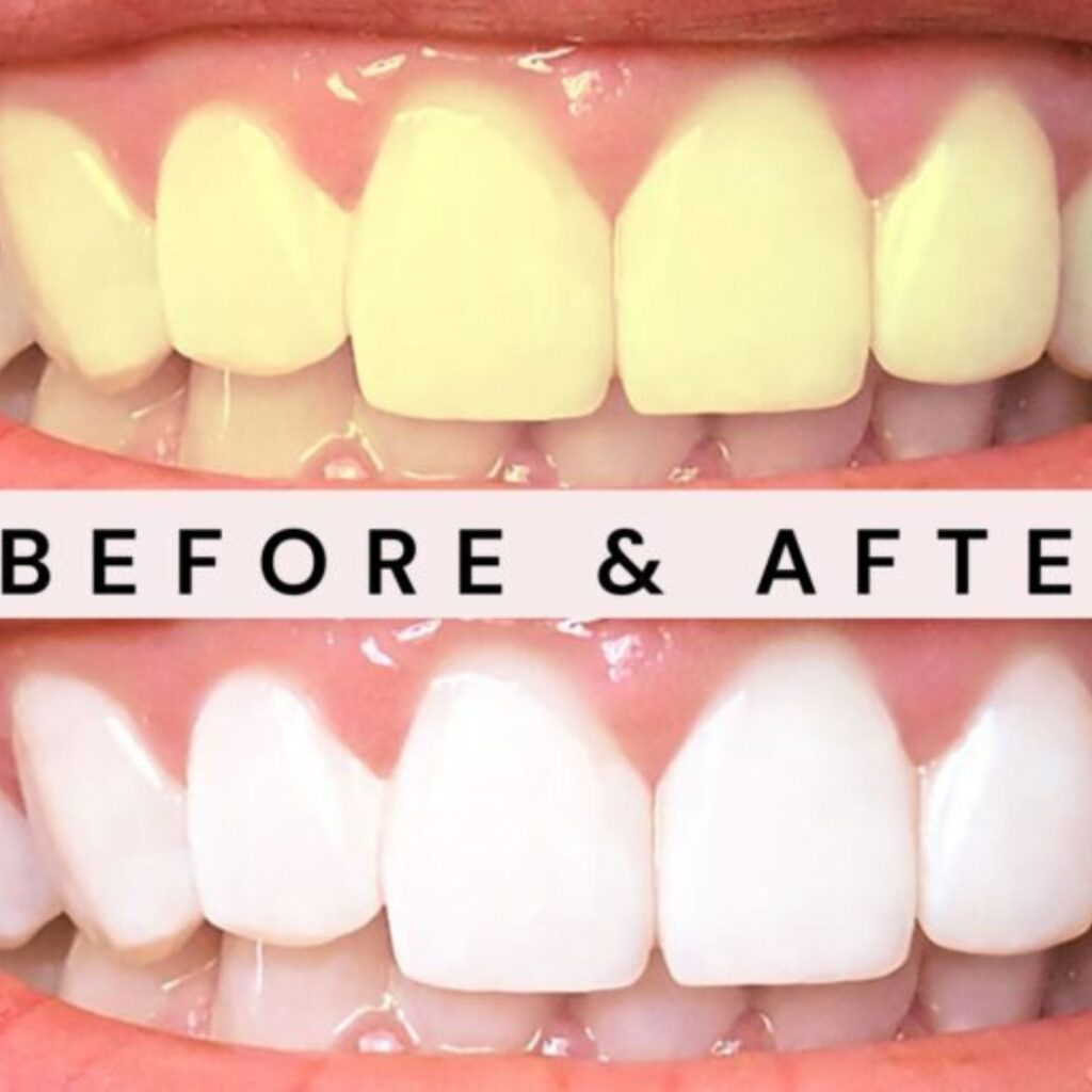 Services - Teeth Empire Dental Clinic
